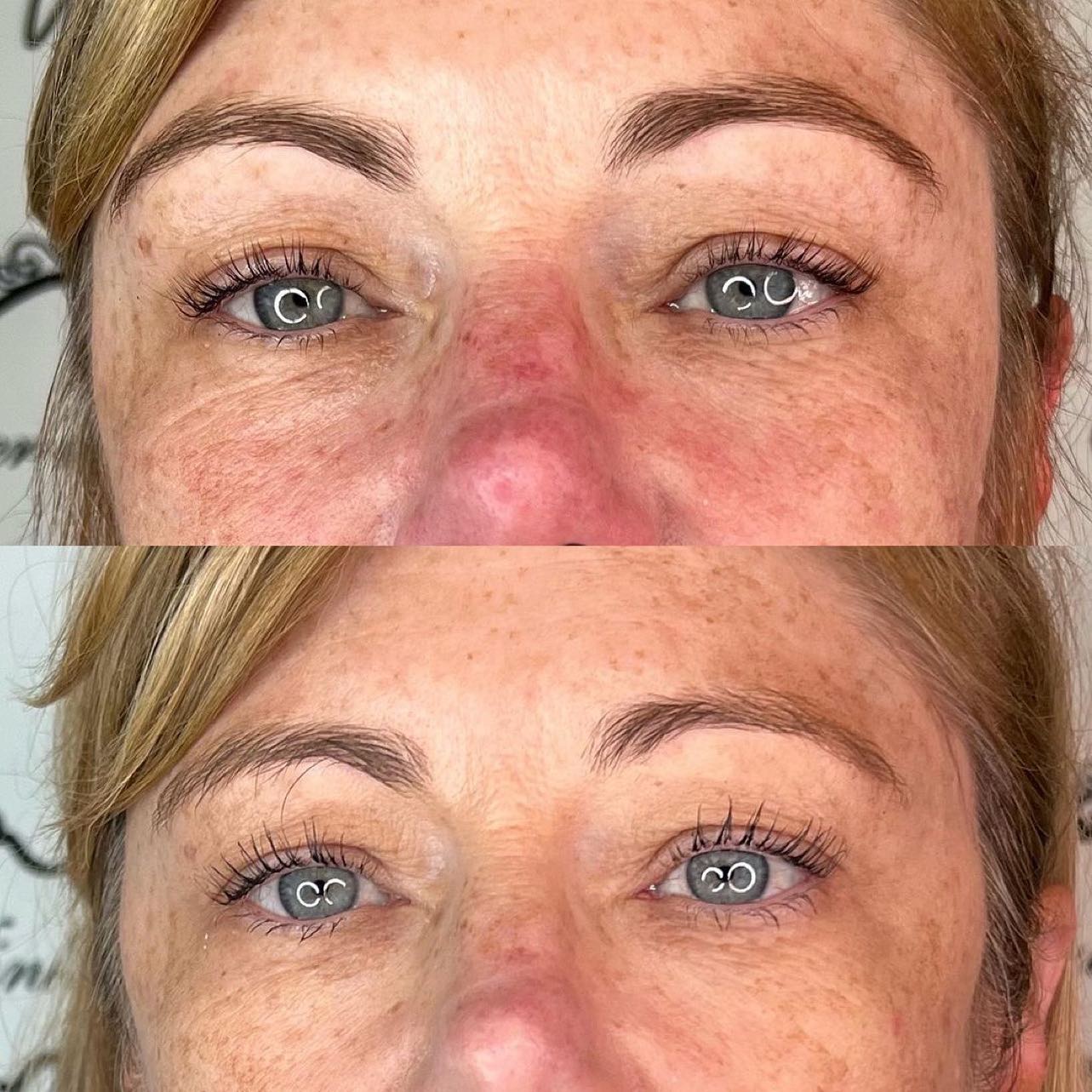 Before and After. Jet Plasma. Pictures. Photos.